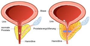 Die Prostata – Anatomie, Funktionen und Gesundheit - Prostata-Vorsorge.net